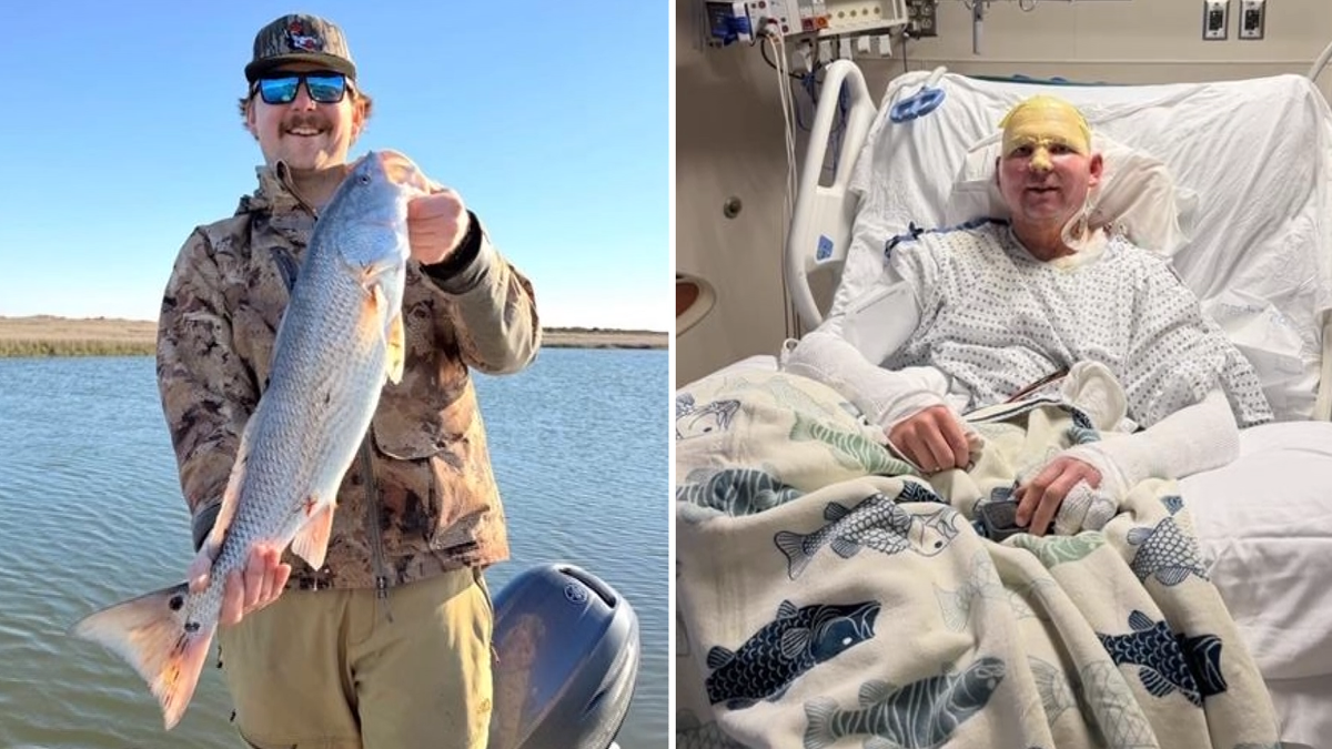 'I'm happy to be alive': Garner man severely burned from boat fire ...
