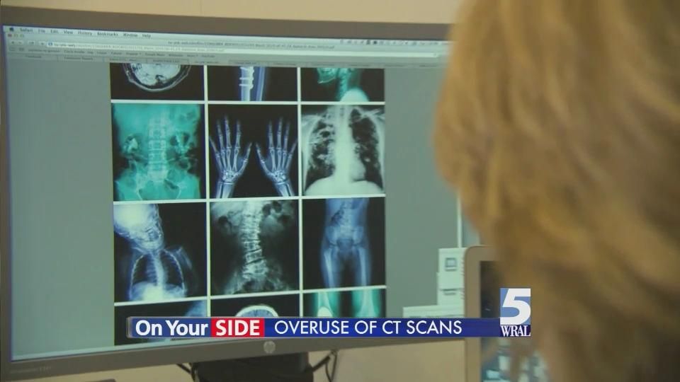 Consumer Reports: CT scans can be dangerous