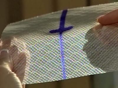 FDA: Pelvic mesh for women riskier than thought