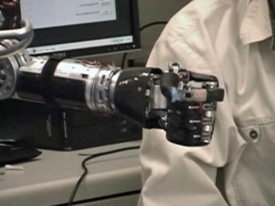 System helps amputee patients better control artificial limbs