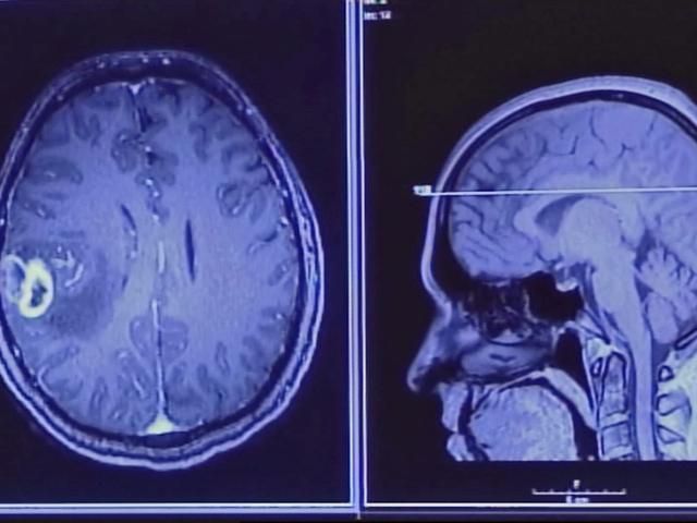 Imaging technology can help diagnose, treat brain diseases
