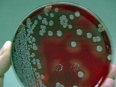 Study: MRSA infections at hospitals rates drop