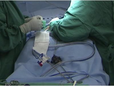 UNC aims to leave no sponges behind