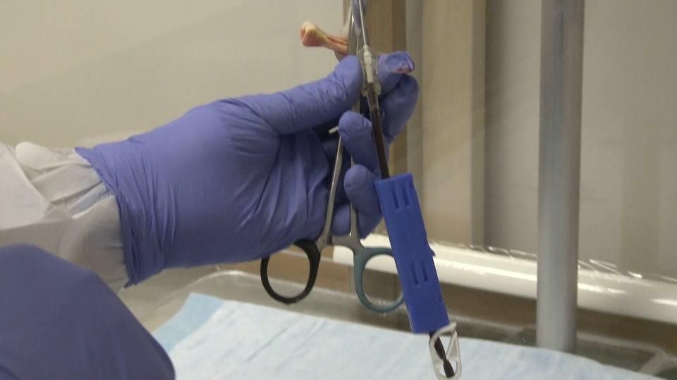 Training helps more hospitals collect life-saving umbilical cord blood