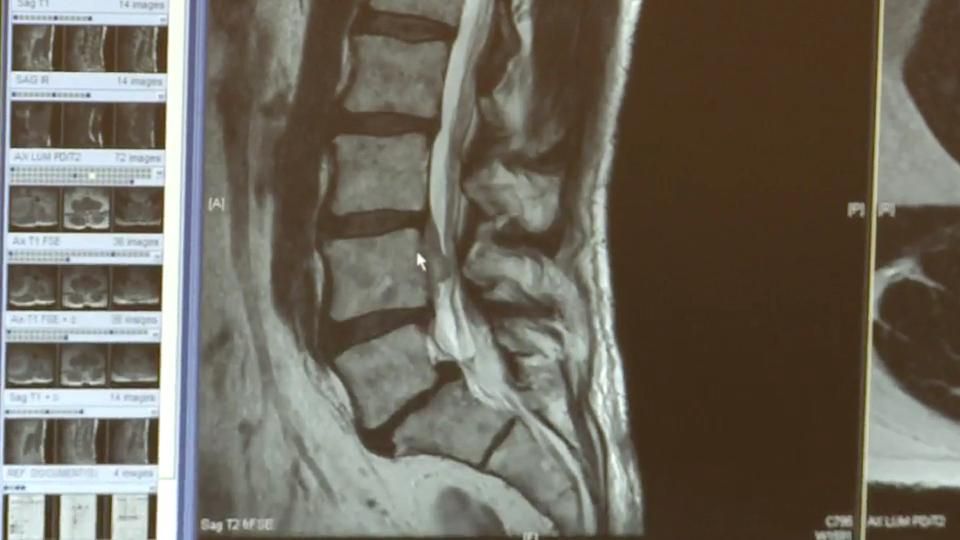 Duke Spine Center changes location to ease patient pain