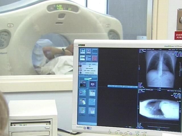 High-Tech Scan Helps Identify Heart Disease Risk