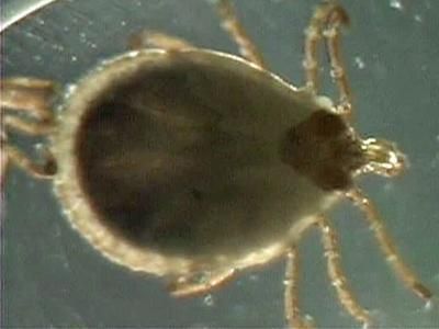 Tick Bites Spread Rocky Mountain Spotted Fever