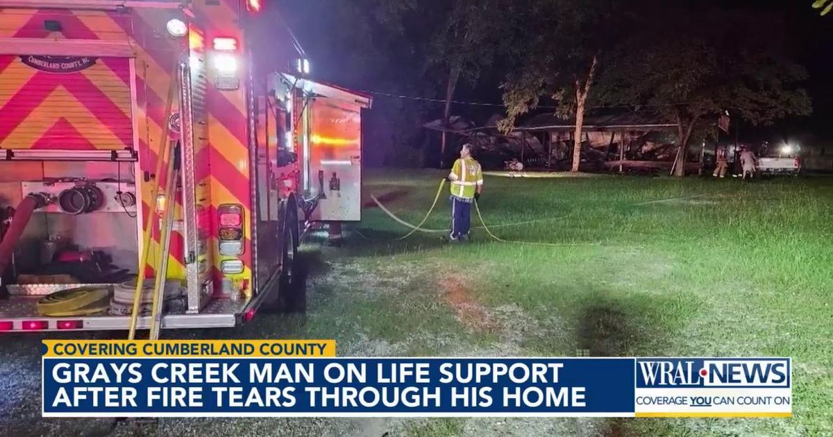 Grays Creek man badly burned in house fire remains in hospital, family ...