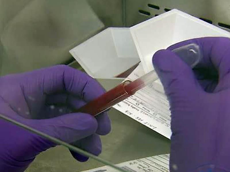 Was science of blood evidence lost in translation to jurors?