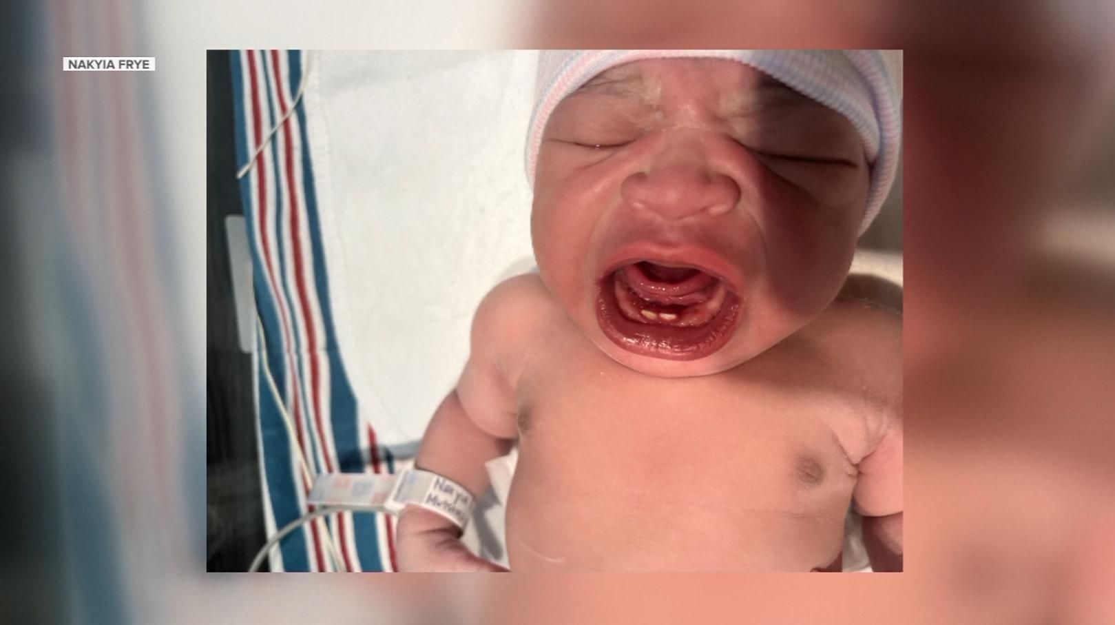 Newborn baby with teeth store